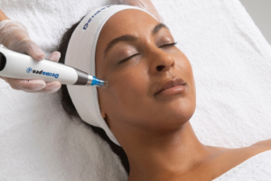 Microneedling with Dermapen 4 | Collagen Boost & Skin Rejuvenation