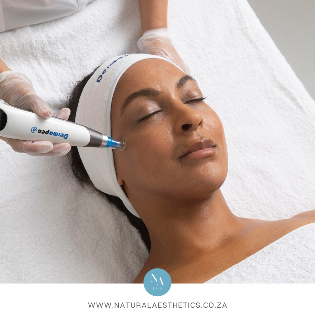 Dermapen Medical Microneedling at Natural Aesthetics Cape Town and ...